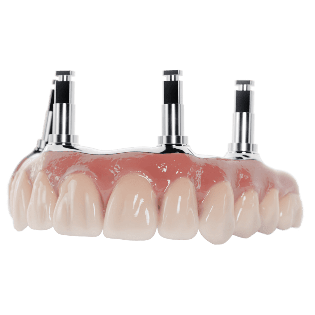 Offering advanced full arch dental solutions with top tier accuracy and ...