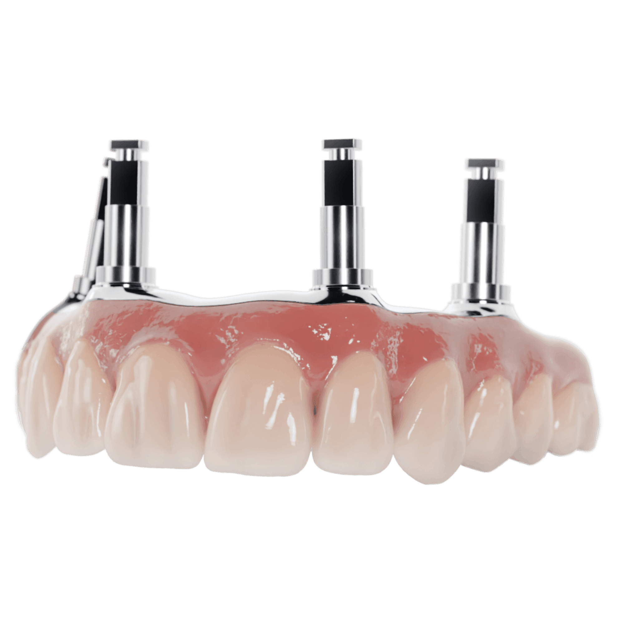Offering advanced full arch dental solutions with top tier accuracy and ...