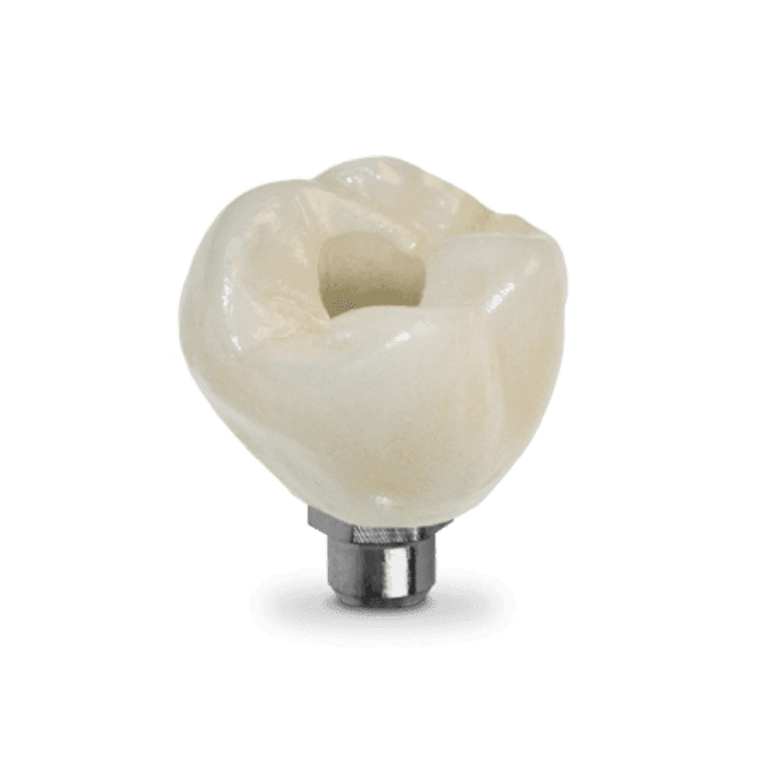 Implant-Based Solution